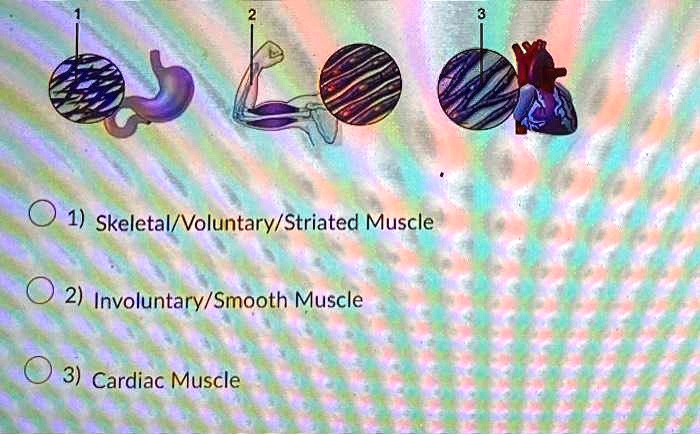 what type of muscle is represented in the image labeled with the number ...