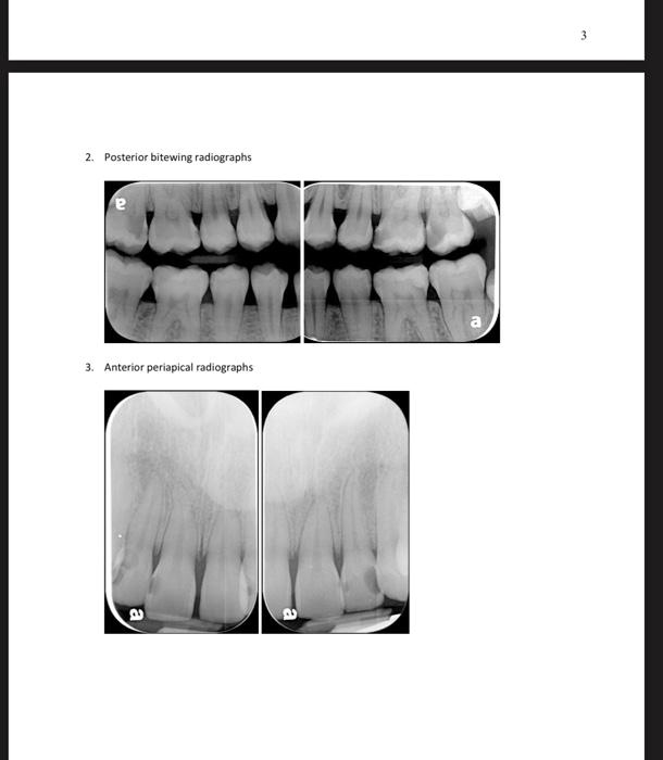 SOLVED: list all dental issues on the radiograph of a 17 year old ...