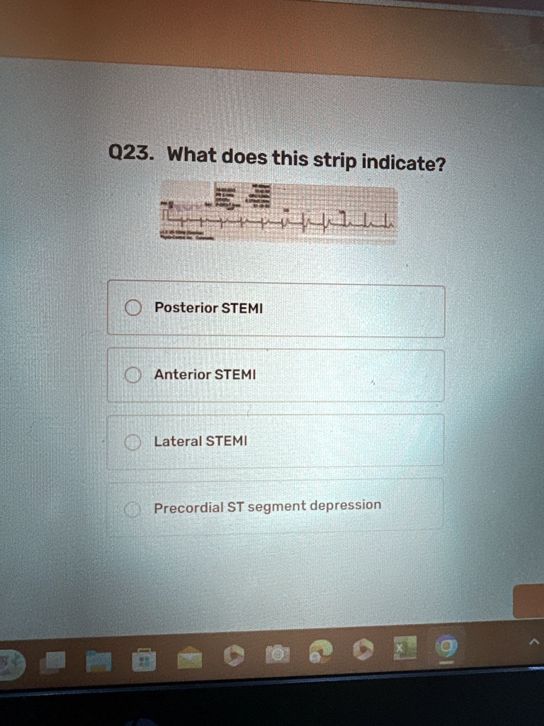 q23 what does this strip indicate posterior stemi anterior stemi ...