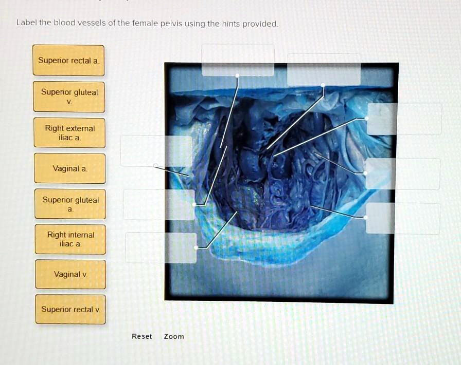 Label the blood vessels of the female pelvis using the hints provided ...