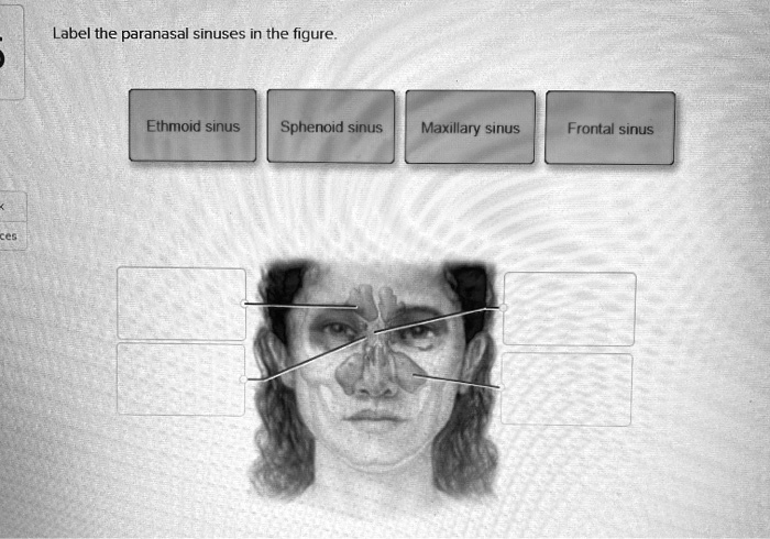 Solved Label The Paranasal Sinuses In The Figure Ethmoid Sinus
