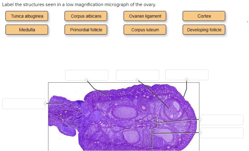 SOLVED: Label the structures seen in a low magnification micrograph of the ovary: Tunica ...