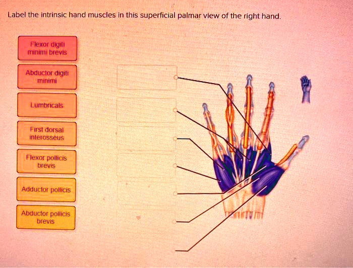 Label the intrinsic hand muscles in this superficial palmar view of the ...