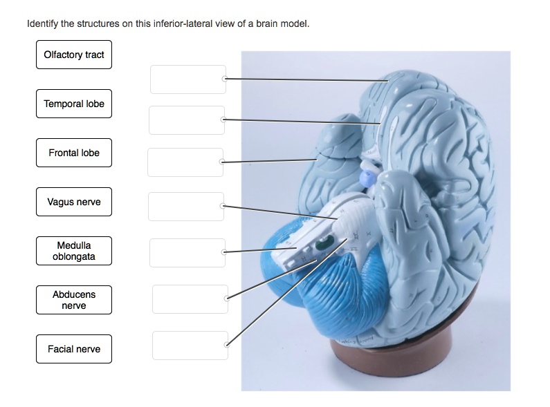 Identify the structures on this inferior-lateral view of a brain model ...