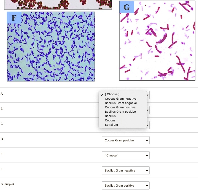 SOLVED: (Choose Coccus Gram negatlve Bacillus Gram negative Coccus Gram positive Bacillus Gram ...