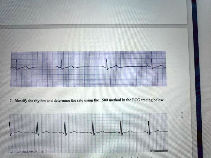 SOLVED: Identify the rhythm and determine the rate using the 1500 ...