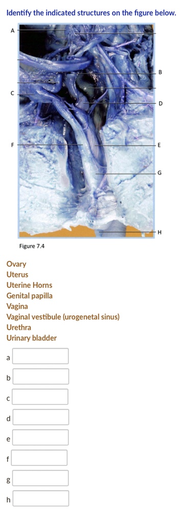 Identify the indicated structures on the figure below. B D E G H Figure ...