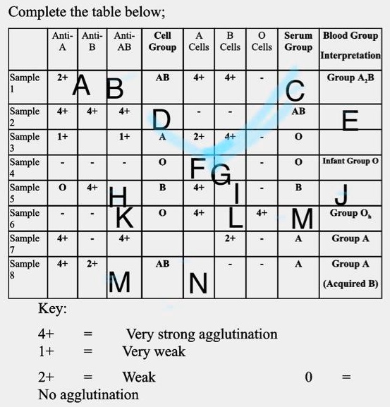 SOLVED: hematology Complete the table below; Anti- Anti- Anti- Cell A B ...