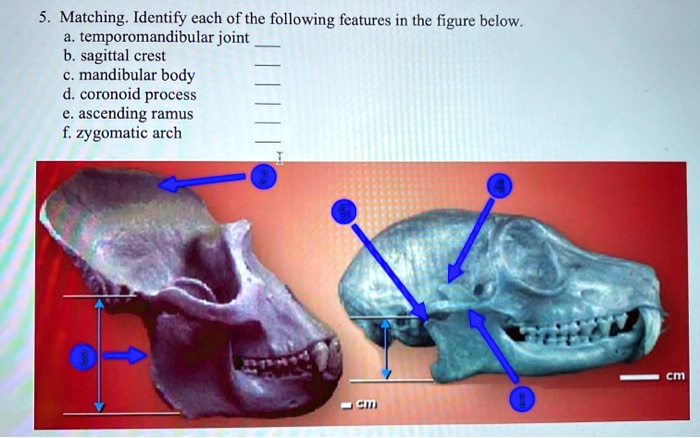 5 matchingidentify each of the following features in the figure below ...