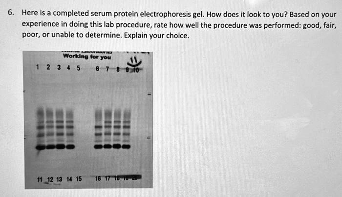 SOLVED: 6.Here is a completed serum protein electrophoresis gel. How ...