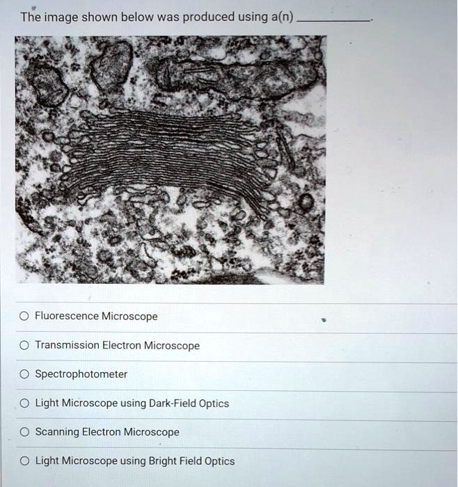The image shown below was produced using a(n) Fluorescence Microscope ...
