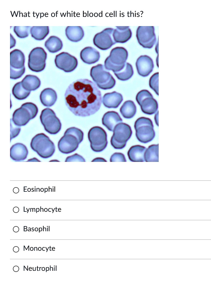 SOLVED: What type of white blood cell is this? Eosinophil Lymphocyte ...