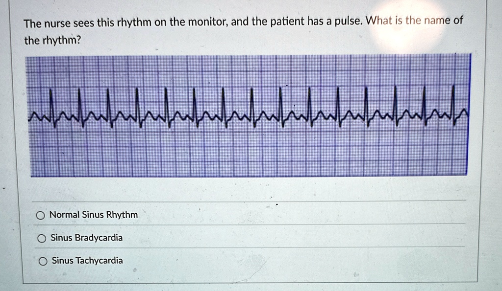 the nurse sees this rhythm on the monitor and the patient has a pulse ...