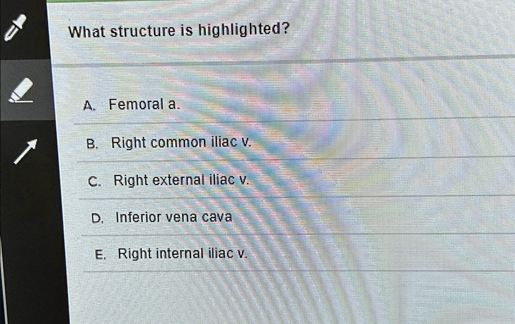 What structure is highlighted? A. Femoral a. B. Right common iliac v. C ...