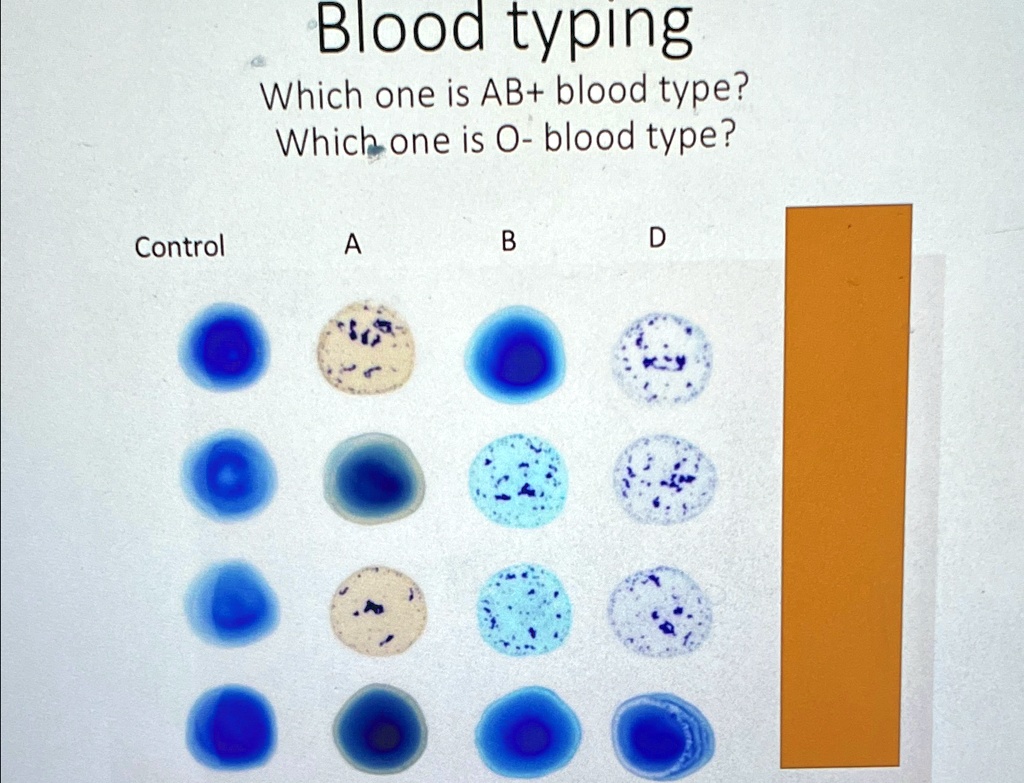 Blood typing Which one is AB+ blood type? Which one is O-...