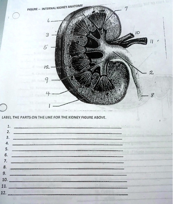 Anatomy Figure: Internal Kidney 12 Label the Parts on the Line for the ...