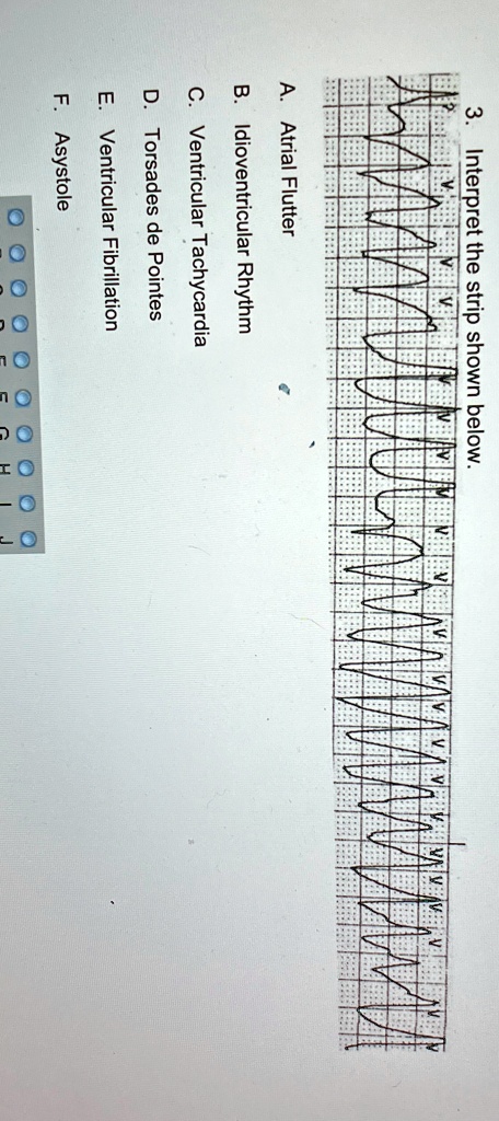 interpret the strip shown below a atrial flutter b idioventricular rhythm c ventricular ...
