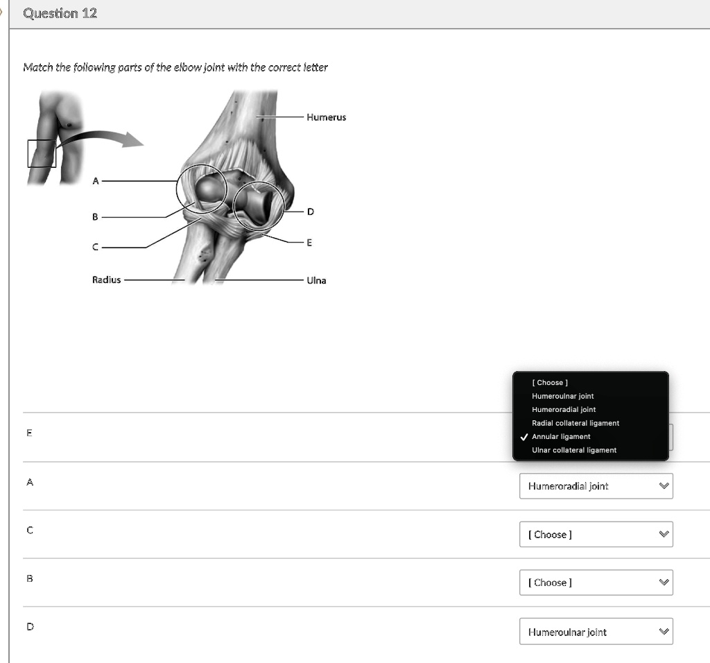 SOLVED: Match the following parts of the elbow joint with the correct letter: A. Humerus B. Ulna ...