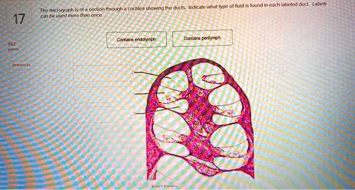 SOLVED: The micrograph is of a section through a cochlea showing the ...