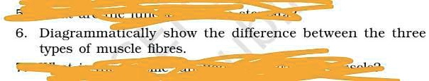 SOLVED: Diagrammatically show the difference between the three types of ...