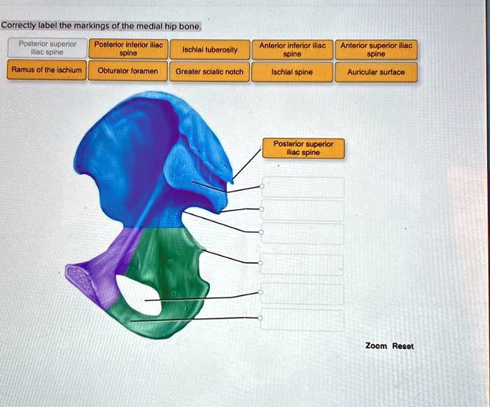 Correctly label the markings of the medial hip bone. Posterior superior ...