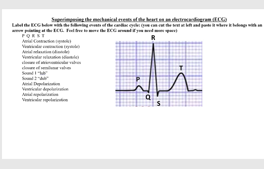 SOLVED: Label the ECG graph Superimposing the mechanical events of the ...