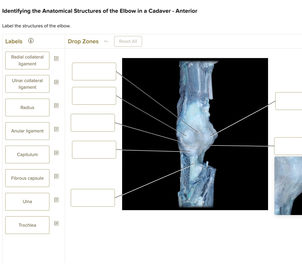 SOLVED: Identifying the Anatomical Structures of the Elbow in a Cadaver ...