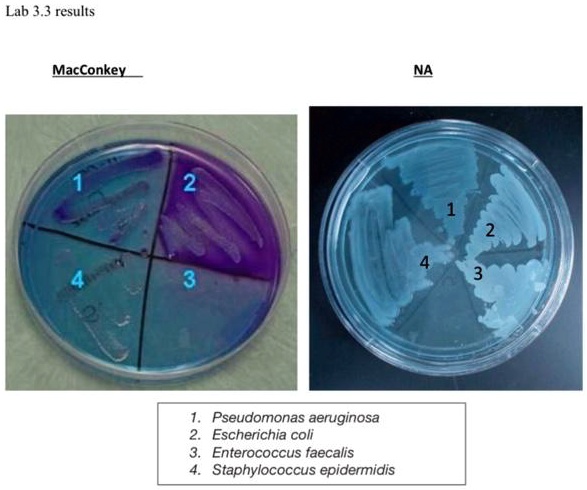 SOLVED: Lab 3.3 results MacConkex NA Pseudomonas aeruginosa Escherichia ...