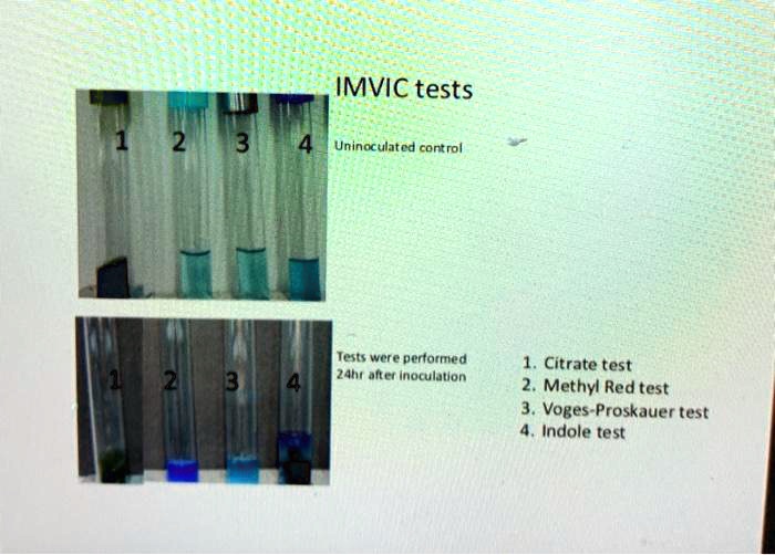 SOLVED:IMVIC tests Uninoculated control Tests were pertormied 24h6 nnet ...