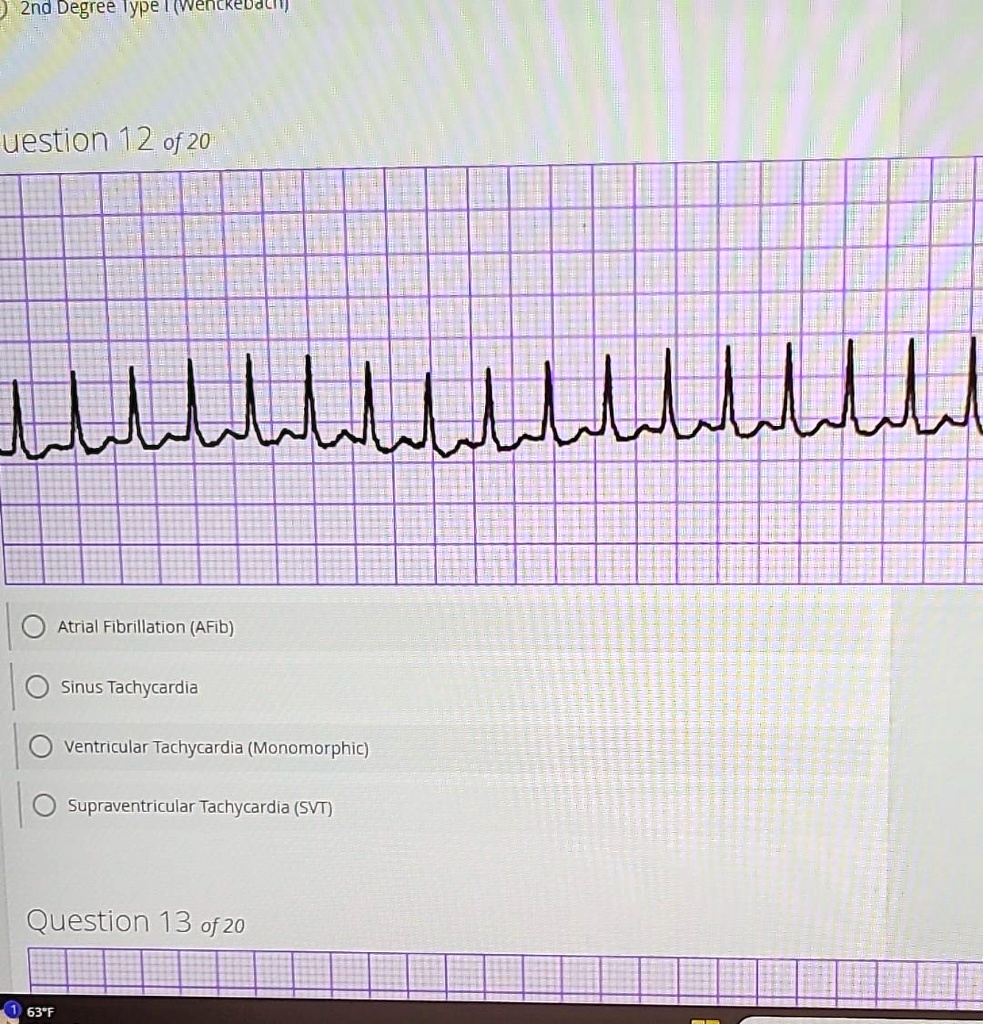 SOLVED: 2nd Degree AV Block (Wenckebach) Question 12 of 20 Atrial ...