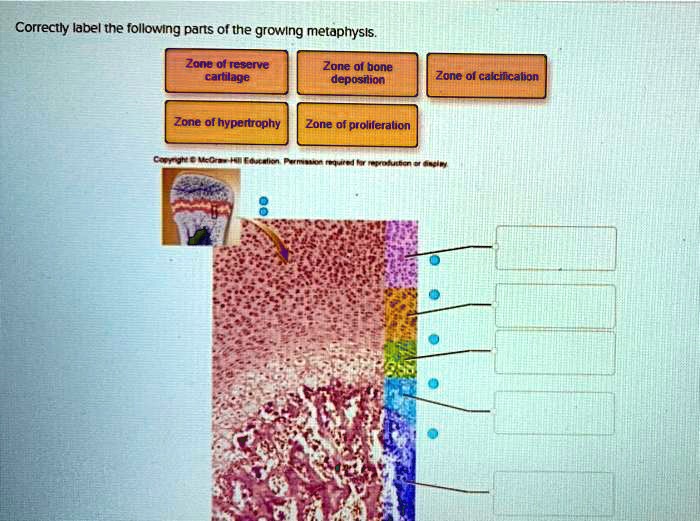 SOLVED: Correctly label the following parts of the growing metaphysis ...