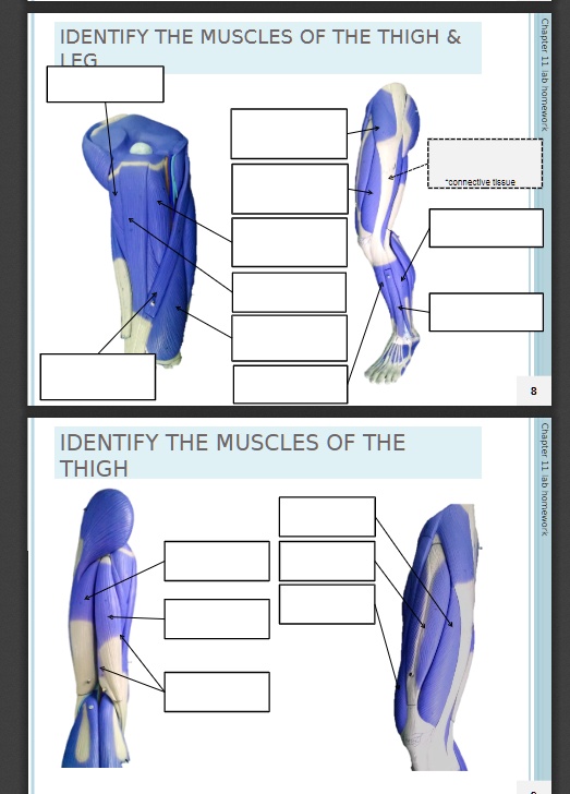 SOLVED: IDENTIFY THE MUSCLES OF THE THIGH LEG SOLVED: IDENTIFY THE MUSCLES OF THE THIGH LEG