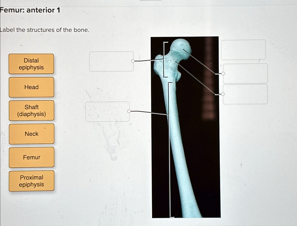 Femur: anterior 1 Label the structures of the bone. Femur:anterior1 ...