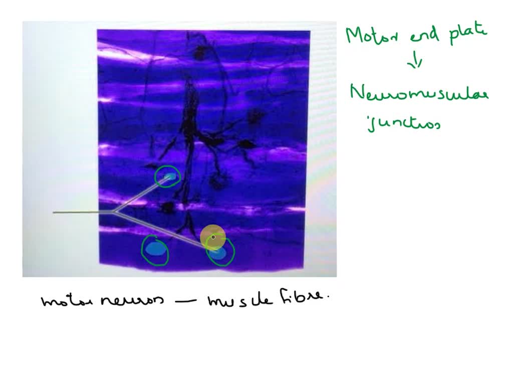 SOLVED: Please help.... Thank you!!! Identify the structure. Muscular ... SOLVED: Please help.... Thank you!!! Identify the structure. Muscular ...