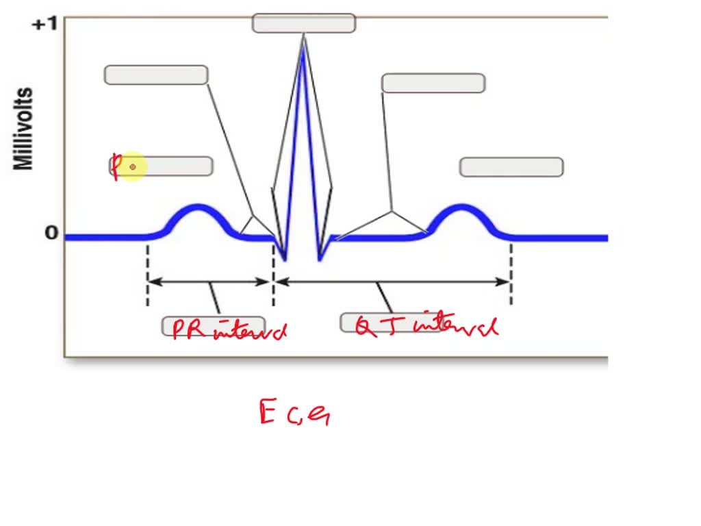 SOLVED: Part B - Electrocardiogram Tracing Drag and drop the correct ... SOLVED: Part B - Electrocardiogram Tracing Drag and drop the correct ...