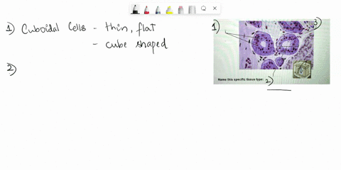 correctly identify this tissue type and then label the features of the ...