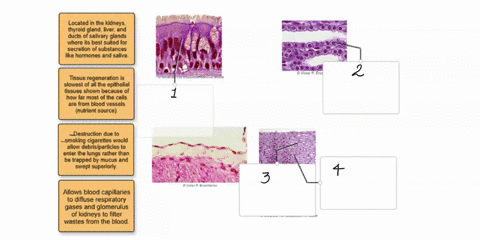 correctly identify this tissue type and label the features of the ...