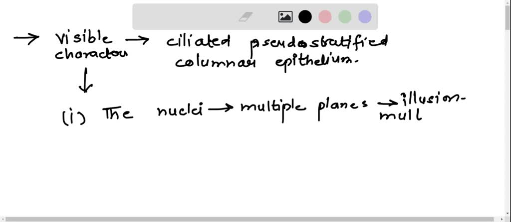 SOLVED: Identify the adaptations visible on the apical surface of the ...