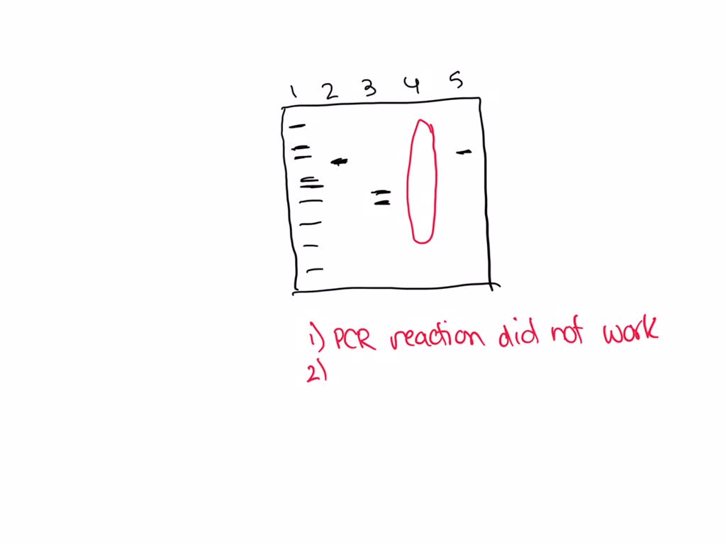 SOLVED: Lane 4 does not show any visible DNA. Which of the following ...