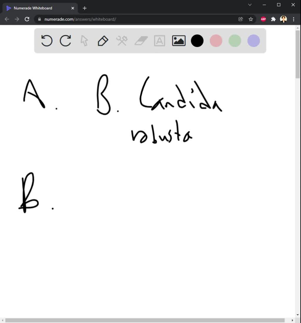 SOLVED: answer these questions about Saccharomyces cerevisiae: a/ The ...