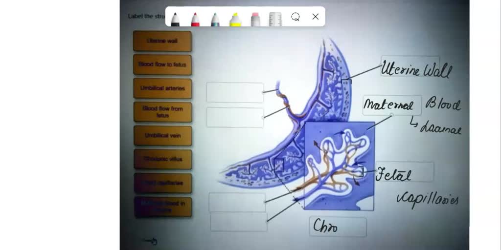 SOLVED: Label Figure 28.12 with the terms below: - Amnion - Maternal ...