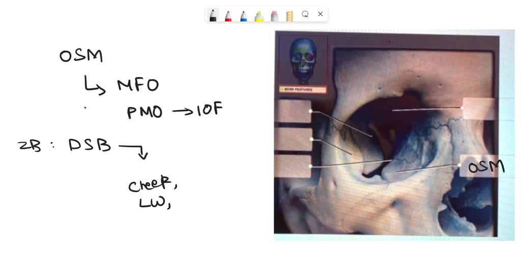 SOLVED: Choose Orthograde Tympanic tube Forward facing eyes Toothcomb 3 ...