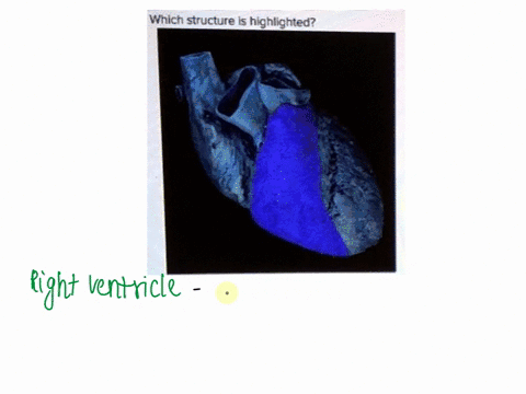 Which structure is highlighted left anterior ventricular...