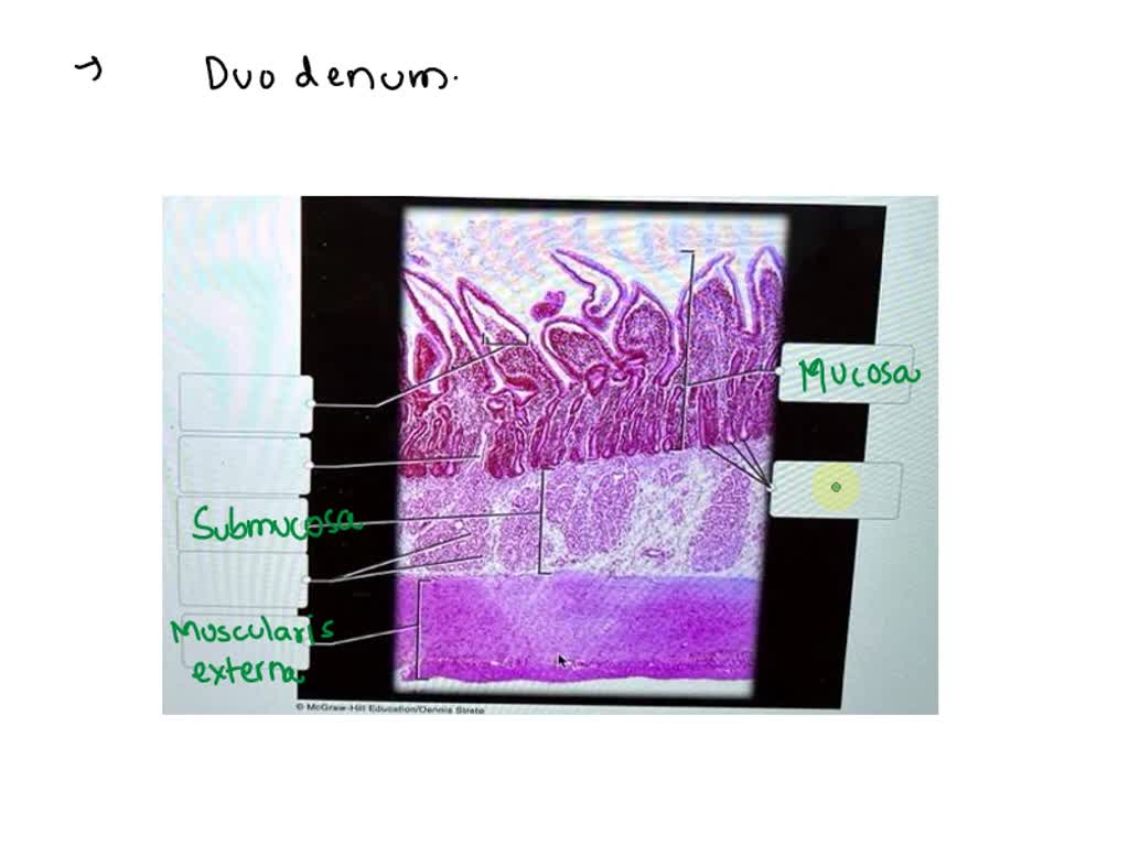 Solved Label The Histologic Features Of The Duodenum Using The Hints
