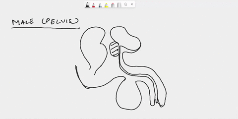 Identify Organs in a Cadaveric Transverse Section Through Pelvis Label ...