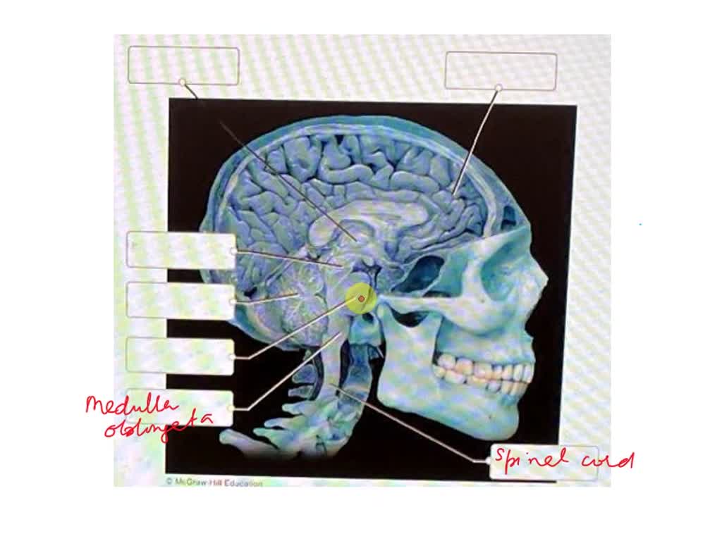 SOLVED: Label the sagittal section of the brain and spinal cord ...