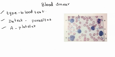 Label: (a) Nucleus (b) Cytoplasm (c) Cell Membrane SQUAMOUS...