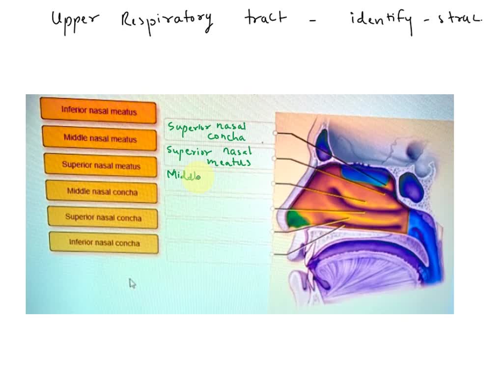 SOLVED: Which structure is highlighted? - trachea - epiglottis ...