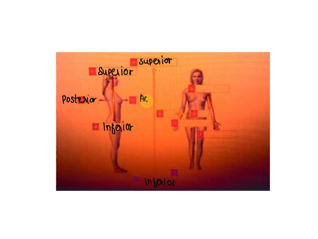 SOLVED: Diagram - label the anatomical directions A, B, C, D, E. 8 ...