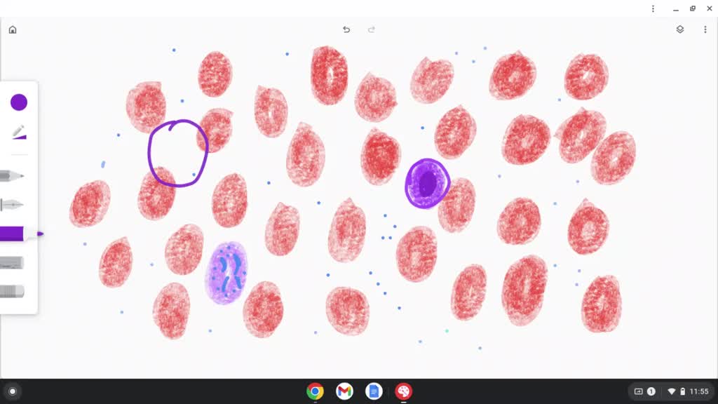 SOLVED: Draw and clearly label a sketch from the Human Blood, Normal ...